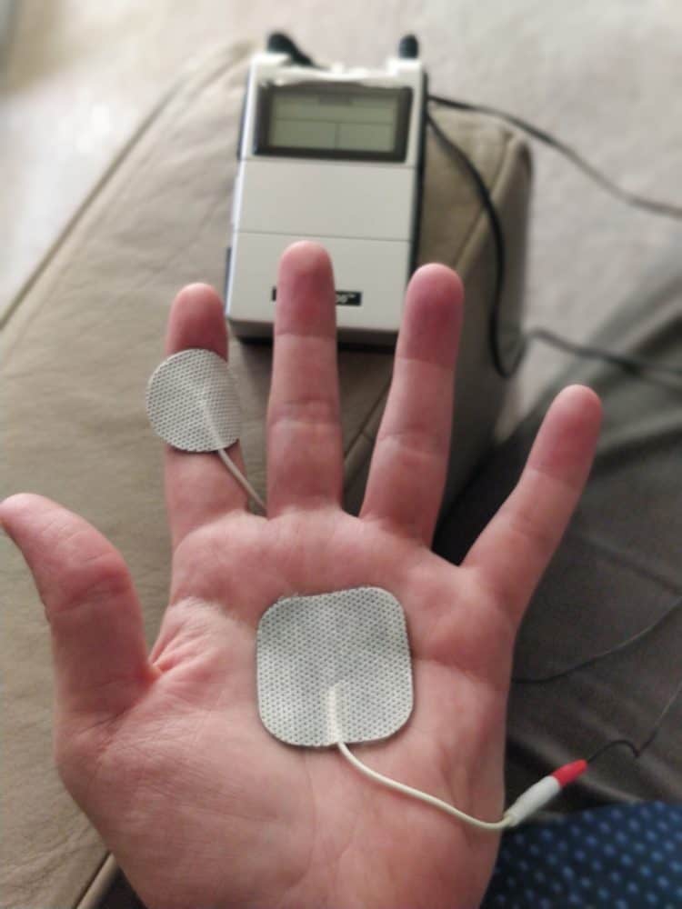 Stop Trigger Finger Pain With A TENS Unit - Optimize Health 365